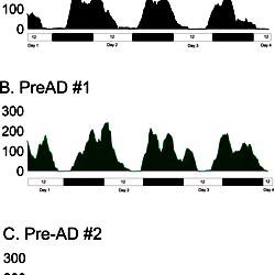 Individual wrist actigraphy examples.