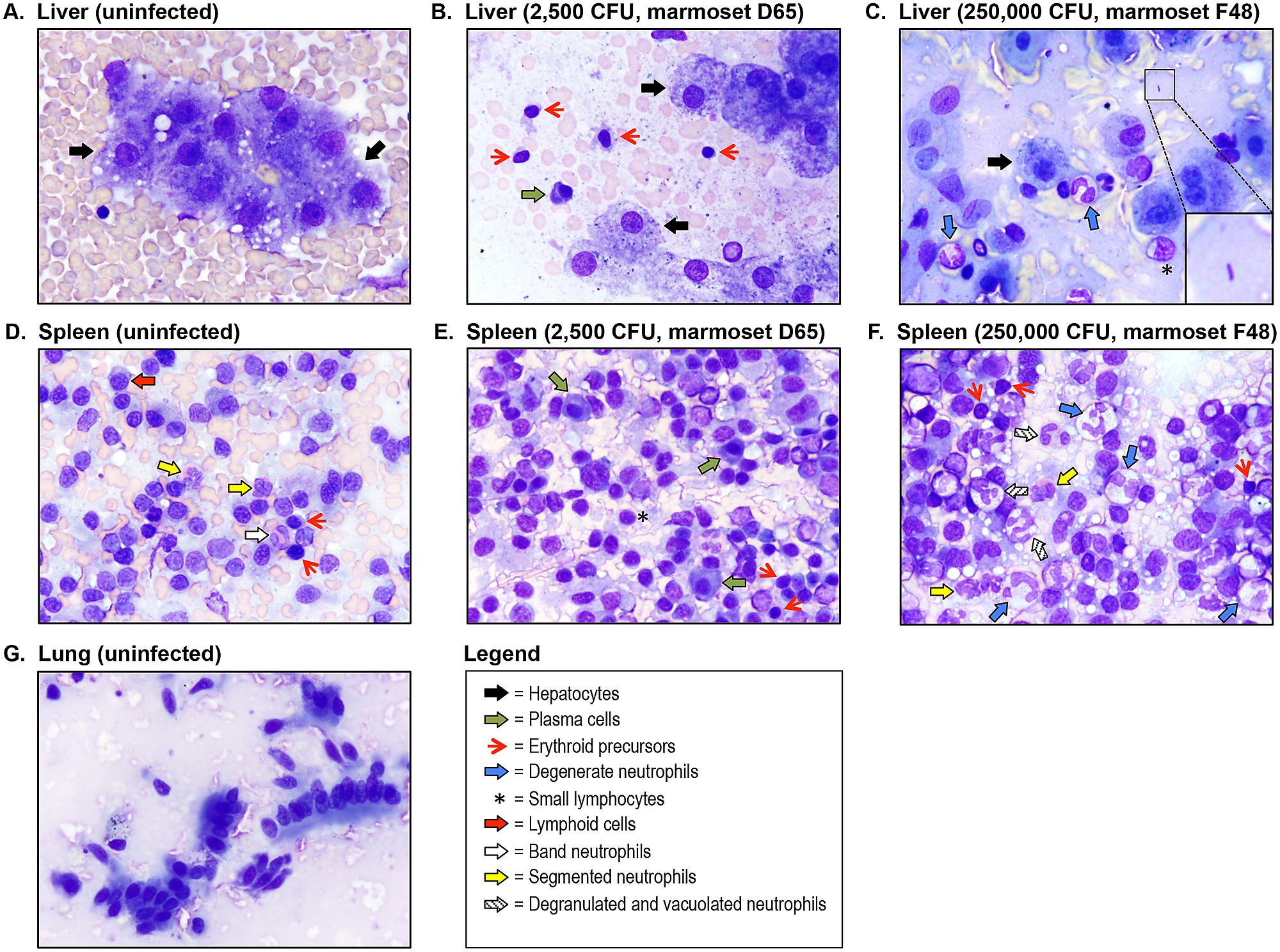Lymphocyte Vs Plasma Cell