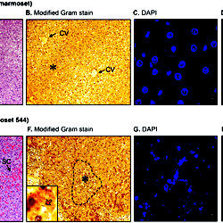 Histologic and immunofluorescence examination of liver tissues.
