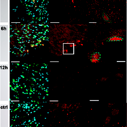 Arc protein nucleo-cytoplasmic localization.