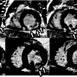 Example study images from an acute myocardial infarction patient with ...