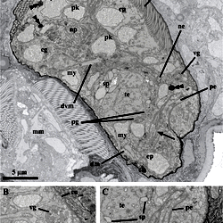 Anatomy of the young male inside the attached Prometheus larva of ...