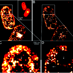 Structural imaging mode.