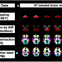 Procedure for image preprocessing.