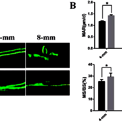 Item - Dynamic bone formation illustrated by calcein double labeling ...