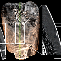 Retzius lines and perikymata doubling in the LLI1 of KB 5223.