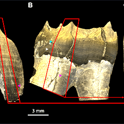 EDJ matching in multiple teeth of a single individual.
