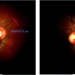 Examples of retinal fundus photographs in our cohort.