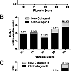 Comparison of Hepatic Collagen Kinetics and Histologic Fibrosis Score.