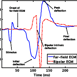 Example of a beat waveform.