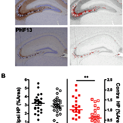 PHF13 reduces contralateral hippocampal tau pathology in PS19 mice ...