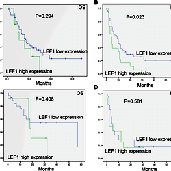 LEF1 mutants promote cell proliferation of ALL cells.