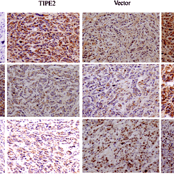 Immunohistochemistry detected TIPE2, Bcl-2, Bax, Caspase-3, Caspase-9 and Ki-67 expression in ...