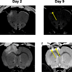 Evolution of hemorrhage post-injury.
