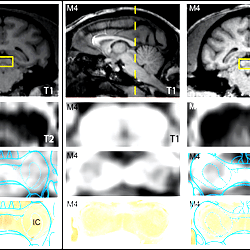 Imaging IC with comparison between MRI modalities and immunolabeled ...