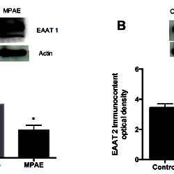 EAAT 1 and EAAT 2 immunoquantification.