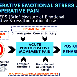 Infographic of preoperative emotional stress and postoperative pain.