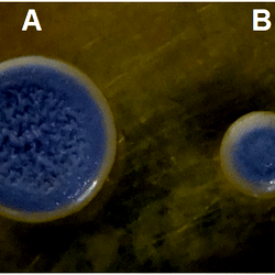 Burkholderia pseudomallei colony morphotypes.