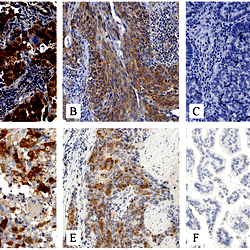 Photomicrographs of RRM1 and RRM2.