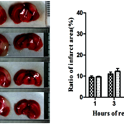 The measurement of infarct volume by TTC staining.
