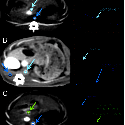 Methods for Perfusion CT scan.