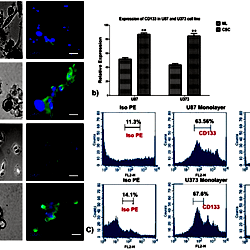 Analysis of cancer stem cell spheroids from U87 and U373 cell lines for ...