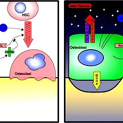 Summary model of microgravity and OSM promoting net bone loss.