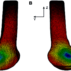 The mapping of the cumulative vertical shift value (cVSV).