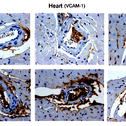 Representative images from immunohistochemical staining for VCAM-1 ...