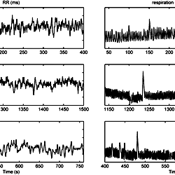 RR interval series and respiratory signals during baseline (BASE ...