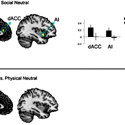 Why Social Pain Can Live on: Different Neural Mechanisms Are Associated ...