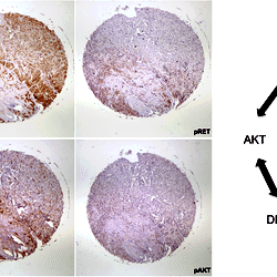 Components of an active RET signaling pathway are observed in MTC and ...
