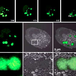 Correlative light and scanning electron microscopy (example 2).