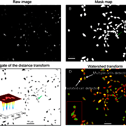 Segmentation of the clustered cells using the watershed method.