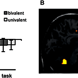 Brain activation in anterior paracingulate cortex when seeing rule symbols.