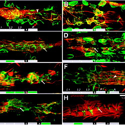 Cardiomyocytes do not re-connect after transient reduction of Talin ...