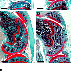Progression of osteoarthritis in injured mouse knee joints.