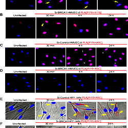 PLA analysis demonstrating the importance of BRCA1 for IFI16 and ASC ...