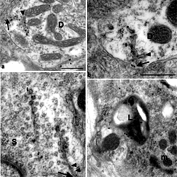 Ultrastructural changes in rec-Prion challenged CD-1 mice detected by ...