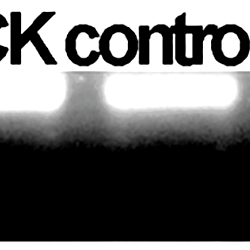 Wild type Pkhd1 in kidneys from PCK rats treated with SD exosomes.