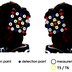 Placement of NIRS probes.