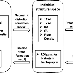DTI processing and brainstem tractography flowchart.