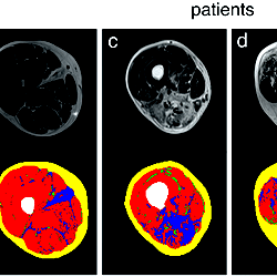 Examples of MR images.