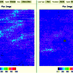 Laser Doppler imaging (LDI).