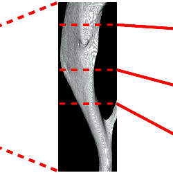 Cross-sections of a mouse tibia between the proximal and distal growth ...