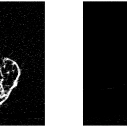 Proximal and distal image slices of a mouse tibia.