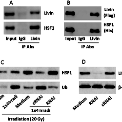 Livin forms a complex with HSF1 in NP69 cells to cause HSF1 ubiquitination.