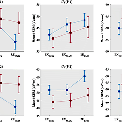 Mean ± SEM of the amplitude of the S wave (), the upstroke slope of the ...