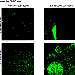 Myosoft: An automated muscle histology analysis tool using machine learning algorithm utilizing ...
