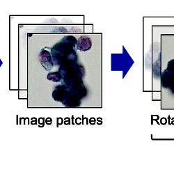 Generation and augmentation of patch images.